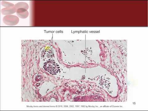 Chapter 15 - Lymphatic System