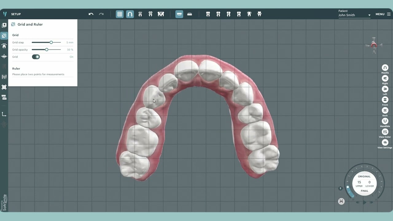 Grid and Ruler | Orthodontic Grid & Measurement Software
