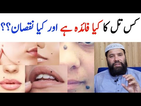 jism par til ka kiya matlab hai | mole on body parts in urdu hindi | kis til se bahut fayda hota hai