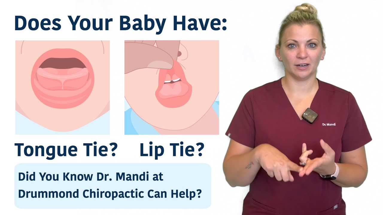 Does your baby have tongue tie? Lip Tie? Difficulty Nursing?