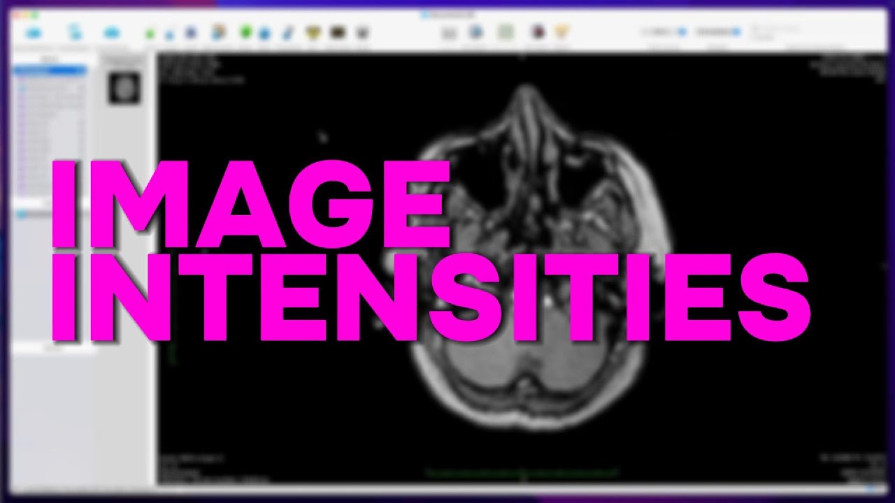 Biomedical Image Intensities with python (Load files, histograms...) 🐍🩻