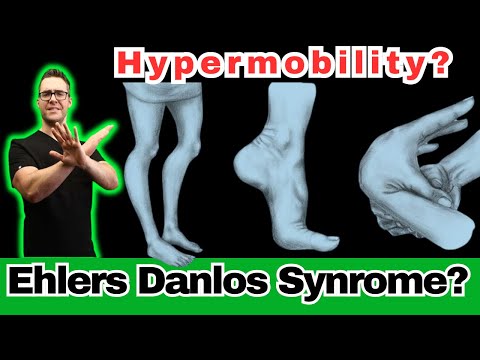 Ehlers Danlos Syndrome [Hypermobility, Symptoms, Diagnosis & Test]