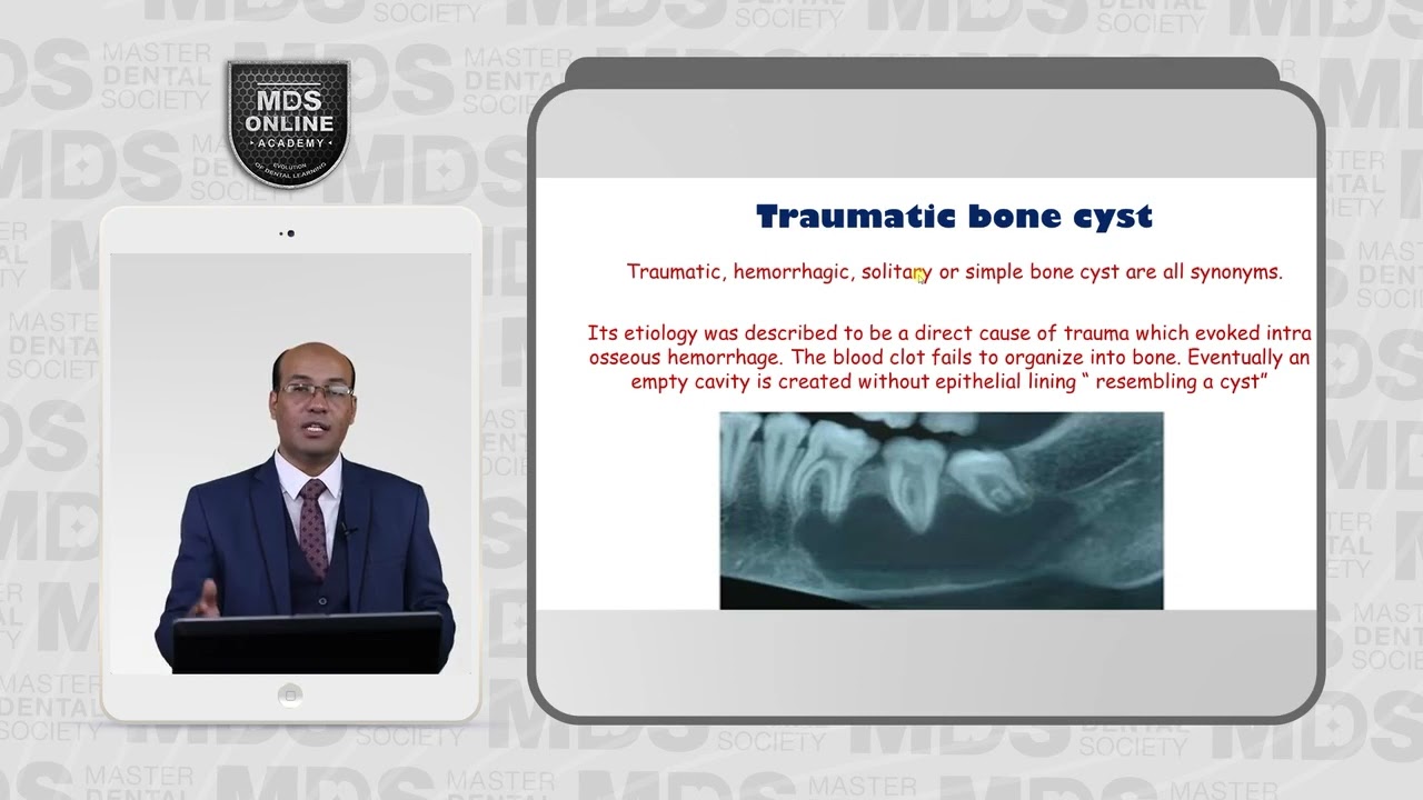 11 2 Traumatic bone cyst
