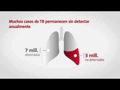 TB-LAMP, Detecci贸n precisa y sencilla de la tuberculosis - Spain