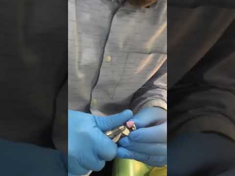 How to do festooning of stainless steel crown?