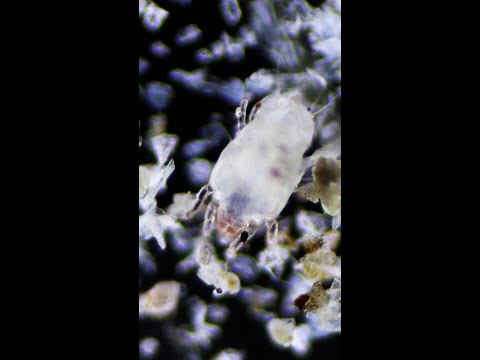 Dust Mites Eat Your Skin And Poop In Your Bed