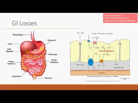 Non-Anion Gap Metabolic Acidosis - GI/GU Losses (See updated video)
