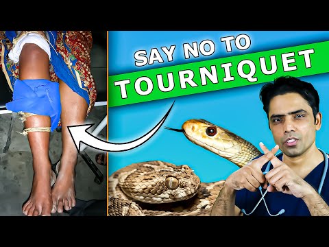 Snake Bite Management Mistakes 🐍 | Is Tourniquet Helpful🤔 ??? #hindi