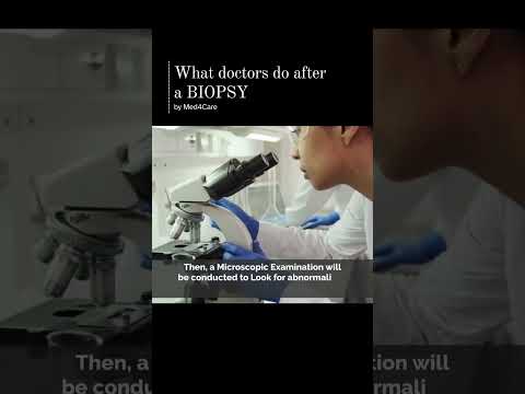 What doctors do after a biopsy