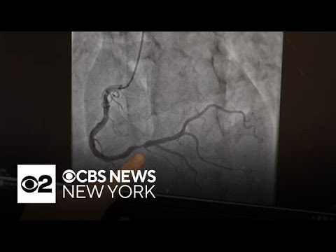 CBS cameraman discusses his genetic risk factor for heart disease