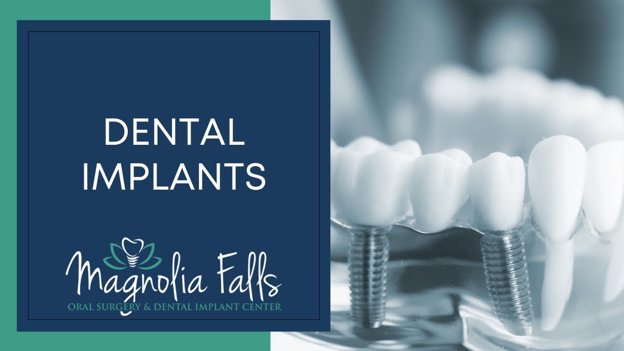 Why Dental Implants Are Your Solution for Missing Teeth