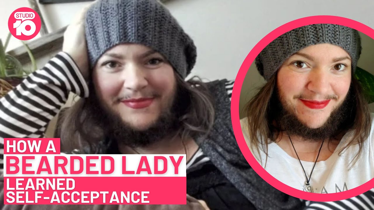 How A Bearded Lady Learned Self-Acceptance | Studio 10