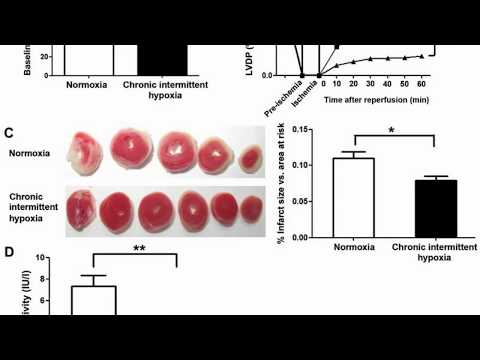 Difference Between Cyanosis and Hypoxia