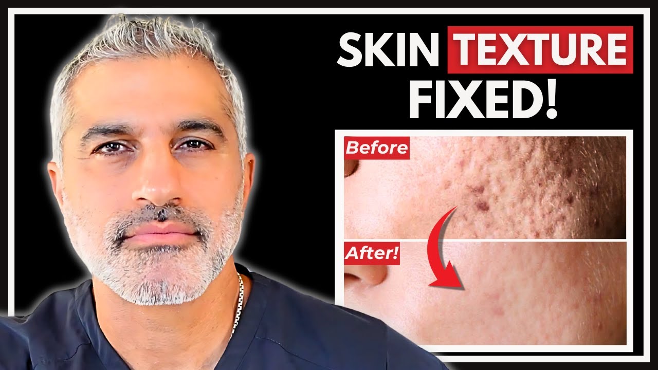 How to Treat Skin Texture & Acne Scars - What Actually Works (Doctor Explains)