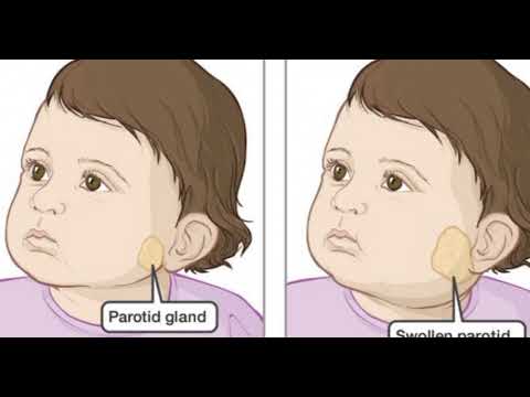 Viral diseases Urdu/Hindi Animation