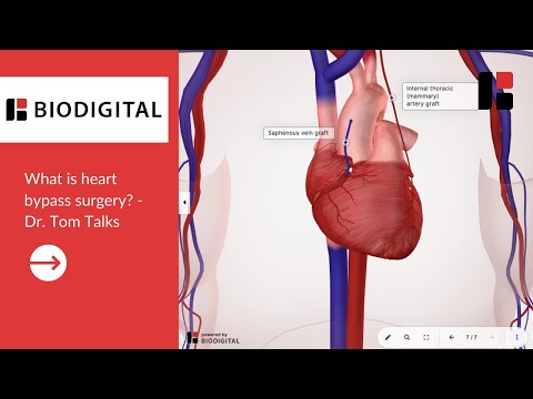 What is heart bypass surgery? - Dr. Tom Talks