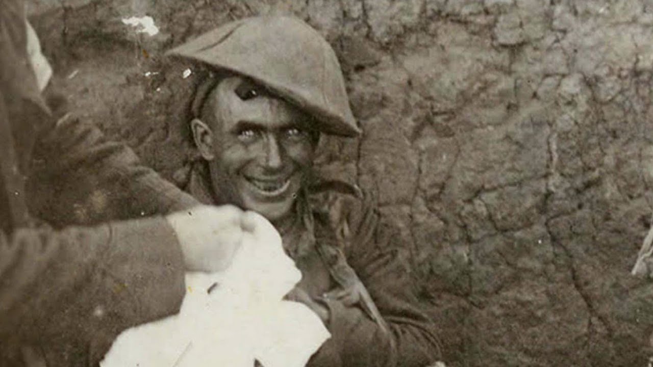 Shell Shock Mystery World War 1