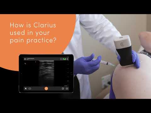 Why Handheld Ultrasound is the Next Big Thing in Pain Management