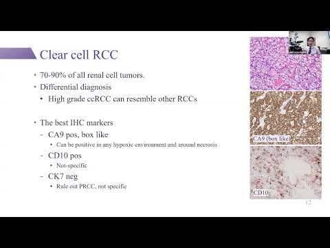 GUPS Virtual Education Series Metastatic renal cell carcinoma 06-06-2025
