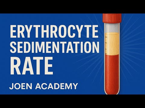 The Erythrocyte Sedimentation Rate (ESR) | Joen Academy