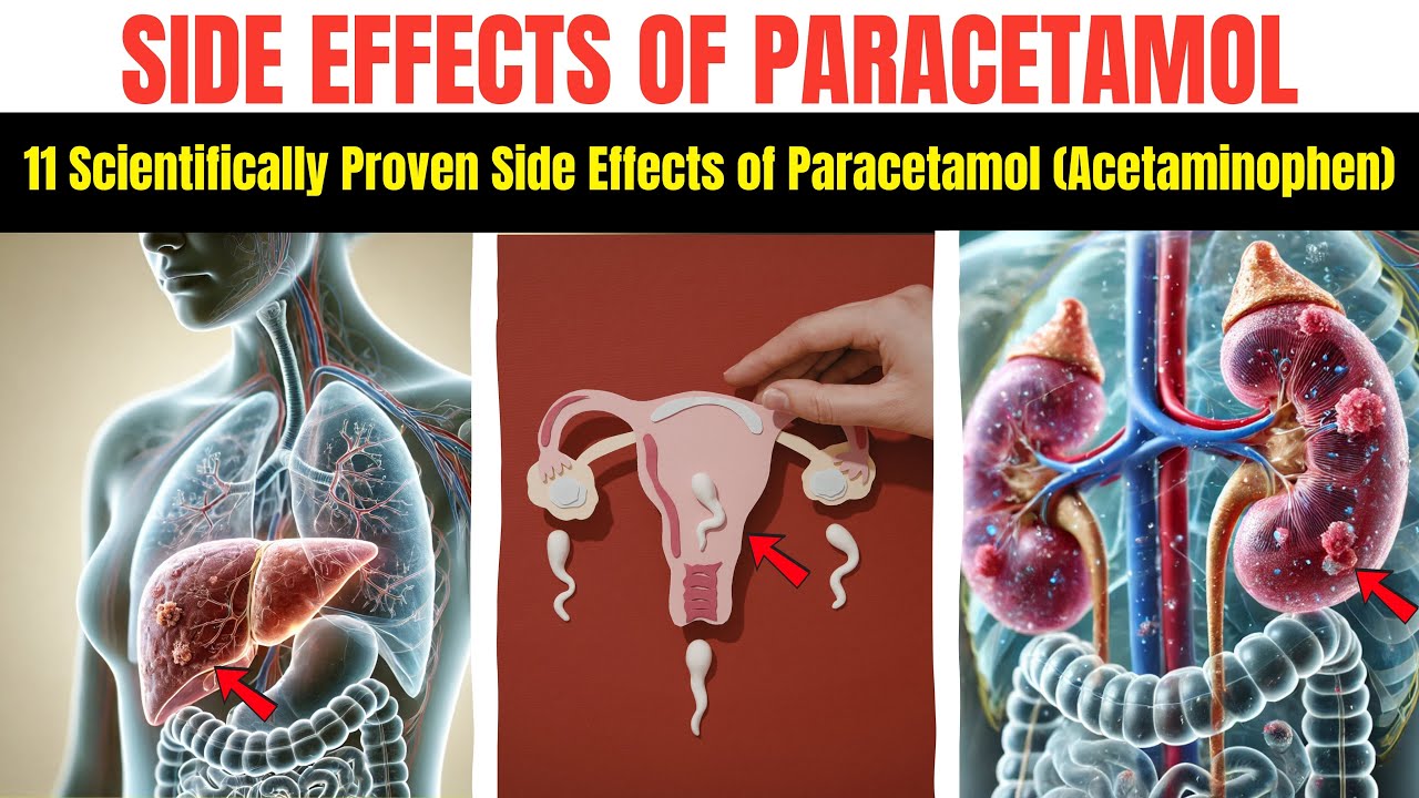11 Scientifically Proven Side Effects of Paracetamol (Acetaminophen) (Doctors Never Say This)