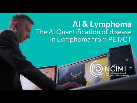 AI & Lymphoma: The AI Quantification of disease in Lymphoma from PET/CT