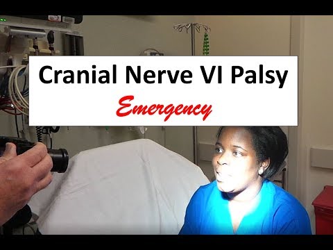 Cranial Nerve VI Palsy Emergency