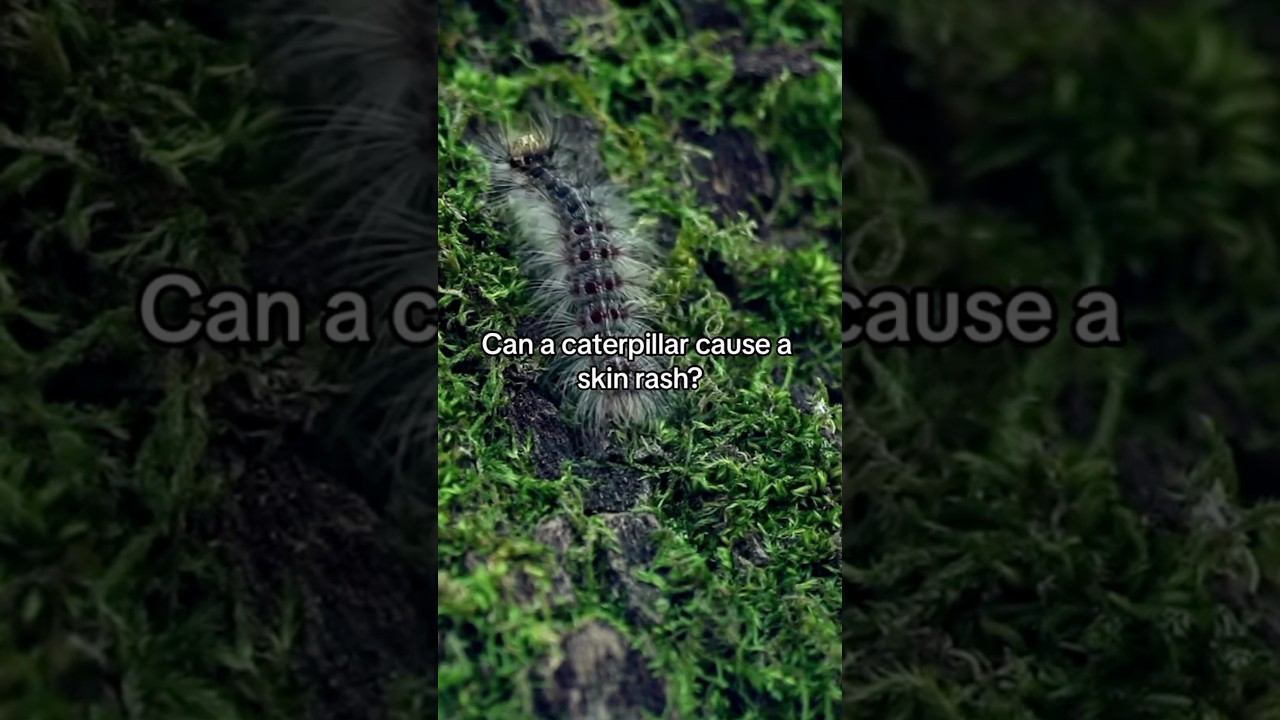 Can a caterpillar cause a skin rash? 🐛