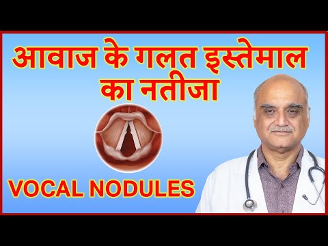 Vocal cord nodule : cause of hoarse voice । आवाज का भारी होना। Hindi। Dr. Rajive Bhatia