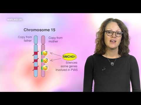 Waking ‘sleeping’ genes could help Prader-Willi syndrome