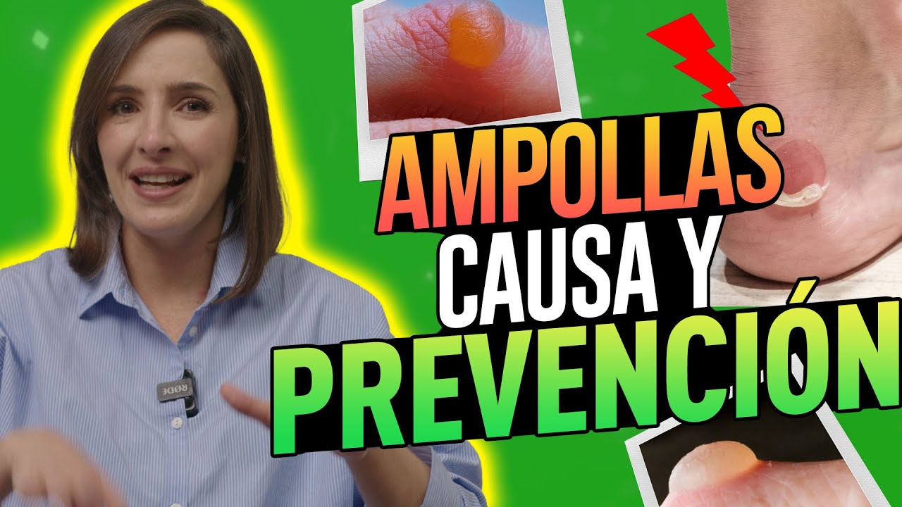 🔴 Should blisters be popped? Dermatologist explains @drapilarochoa - Dermatologist