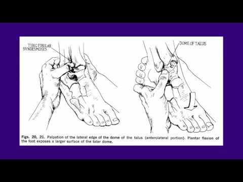 452 Gait Analysis and Differential Diagnosis