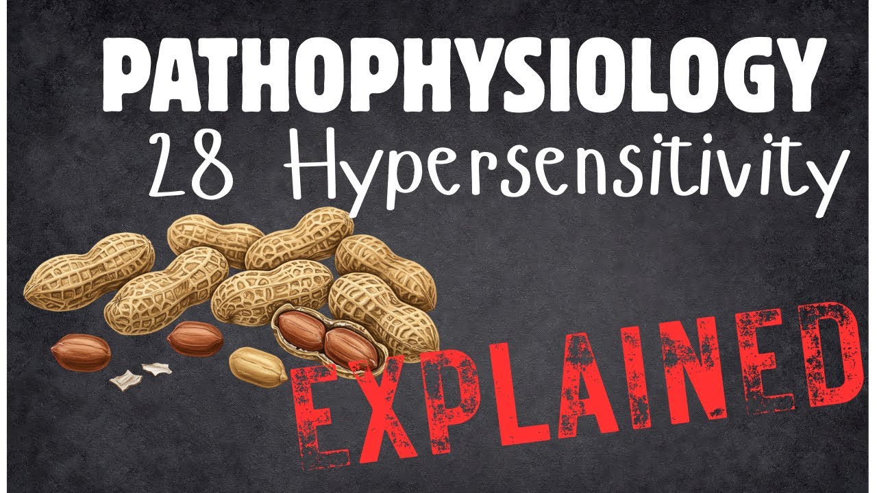 PATHOPHYSIOLOGY essentials EXPLAINED 28   Hypersensitivities