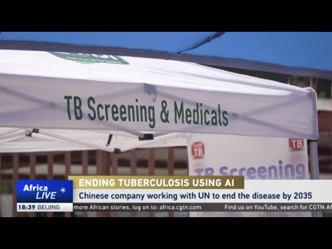 Chinese company aims at ending tuberculosis by 2035