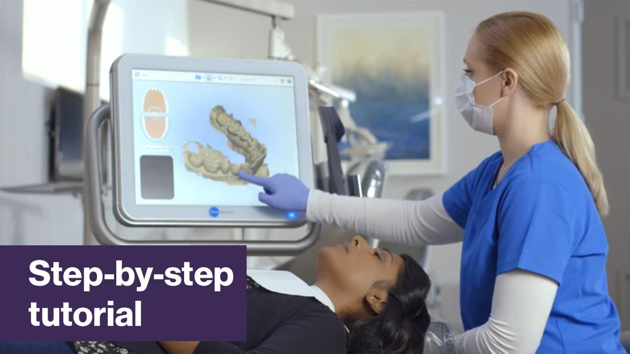 Essential tips for full mouth digital impressions with iTero Element™ intraoral scanner