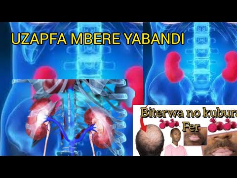 Abasirikare bumubiri bagushizemo UZAPFA VUBA dore wakwirindako bagabanuka vuba