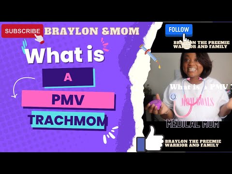 What is a PMV “Passy Muir Valve” -Speaking Valve