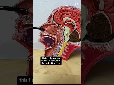 π Guess the Diagnosis: Feeling like something is stuck in your throat?