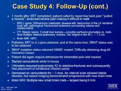 Metastatic Melanoma: Novel Treatments, Adverse Event Management, and Patient Education