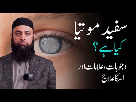 Sfaid Motia Kya hai | Cataract causes, symptoms, treatment in Urdu