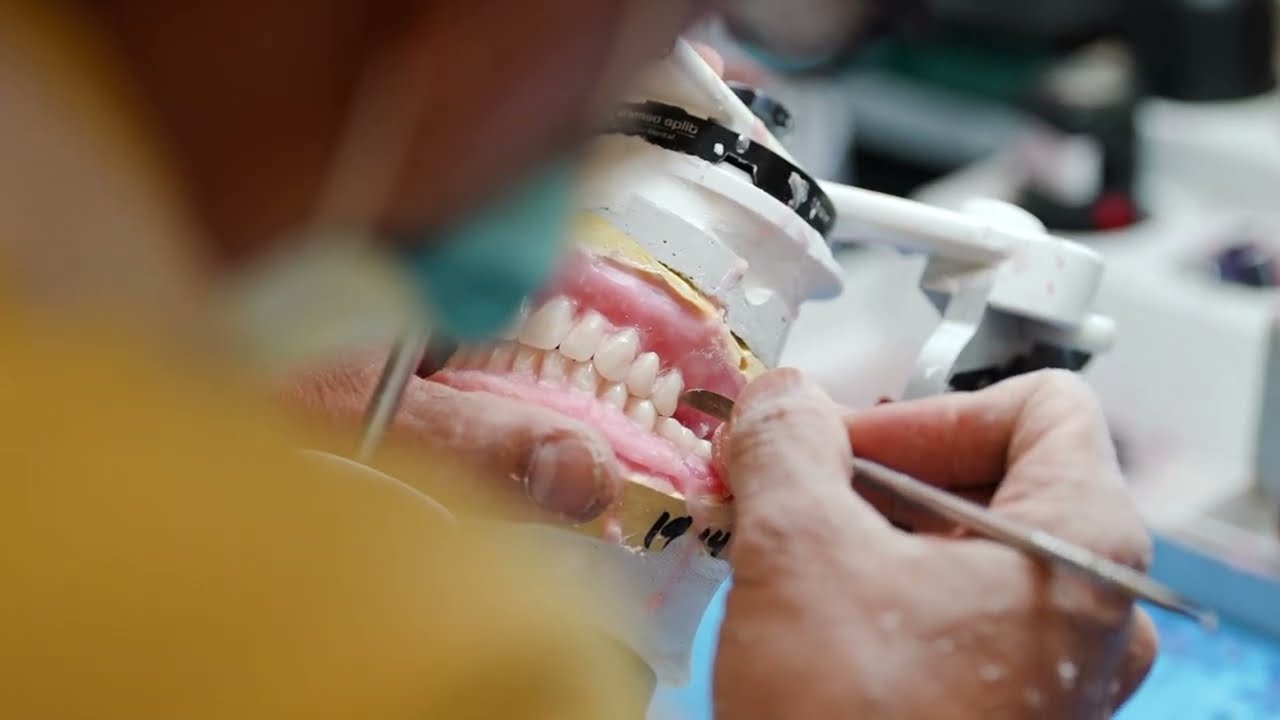 Choose Iverson Dental for a Full Service Dental Lab Experience and learn how to get a free scanner!