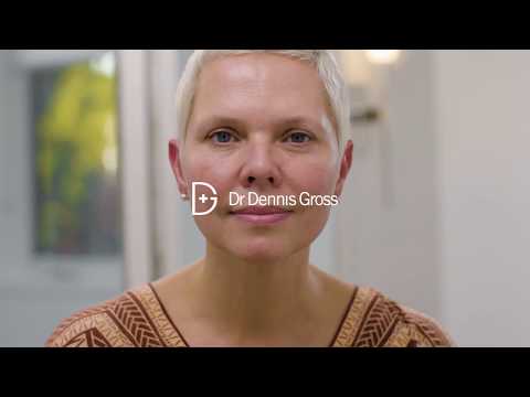 Jane Talks About Her Routine to Correct Hyperpigmentation
