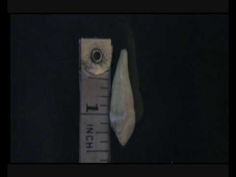 The Worlds Longest Biggest Canine Human Tooth!!