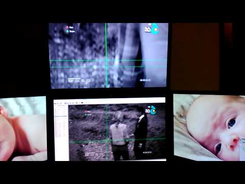 TBS Artefacts