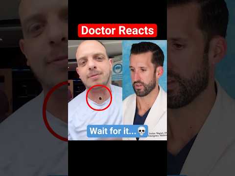 ER Doctor REACTS to Tracheostomy Hole