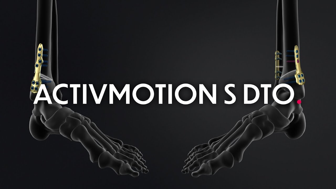 Activmotion S DTO - Distal tibial osteotomy plates