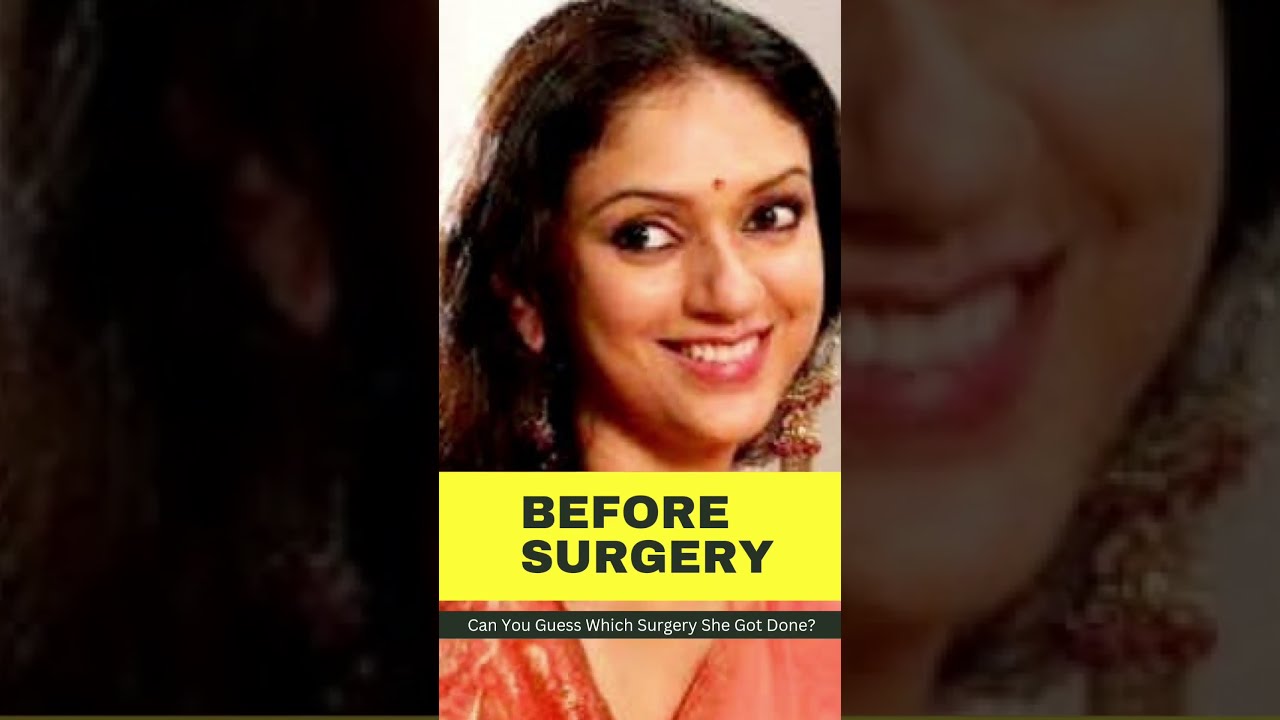 Aditi Rao Hydari Before & After Surgery