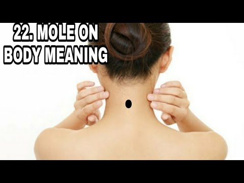 Moles On Body Meaning That You Should Know