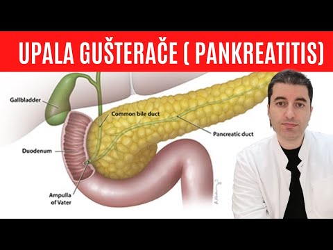 UPALA GUŠTERAČE (PANKREATITIS) - uzroci i simptomi bolesti