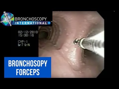 Flexible Bronchoscopy Basic Techniques for Forceps Biopsy